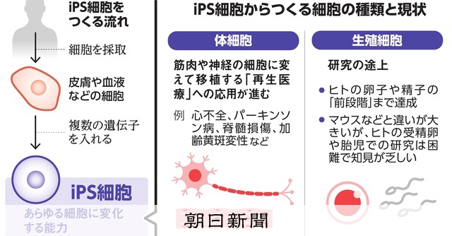 （いちからわかる！）iPS細胞って、どんな能力があるの？：朝日新聞